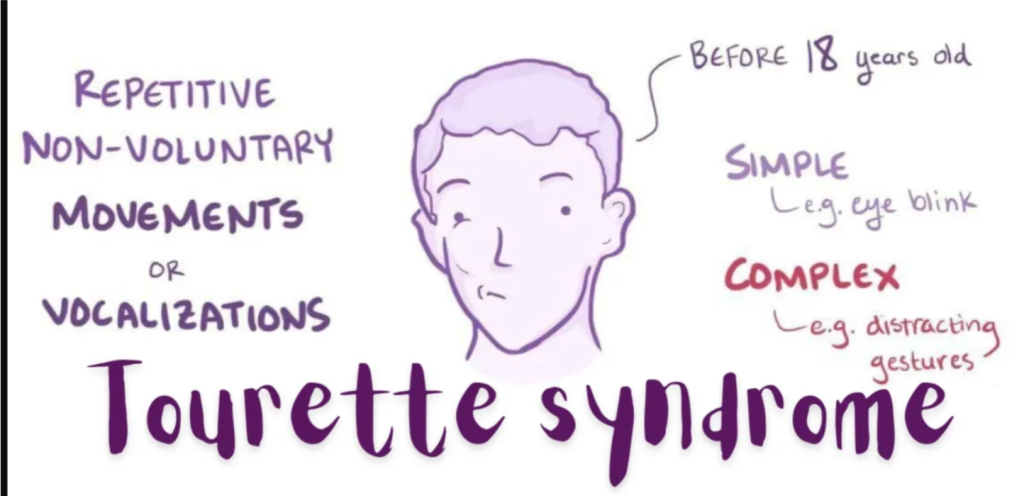 What Is Tourette Syndrome? Symptoms, Causes, History and Treatment ...